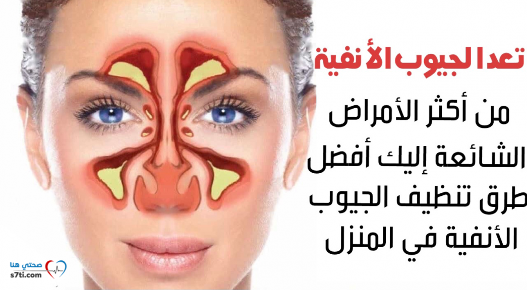 التهاب الجيوب الأنفية يتسبب في الشعور بألم وانزعاج شديد اليك افضل طرق لتنظيفها وعلاجها